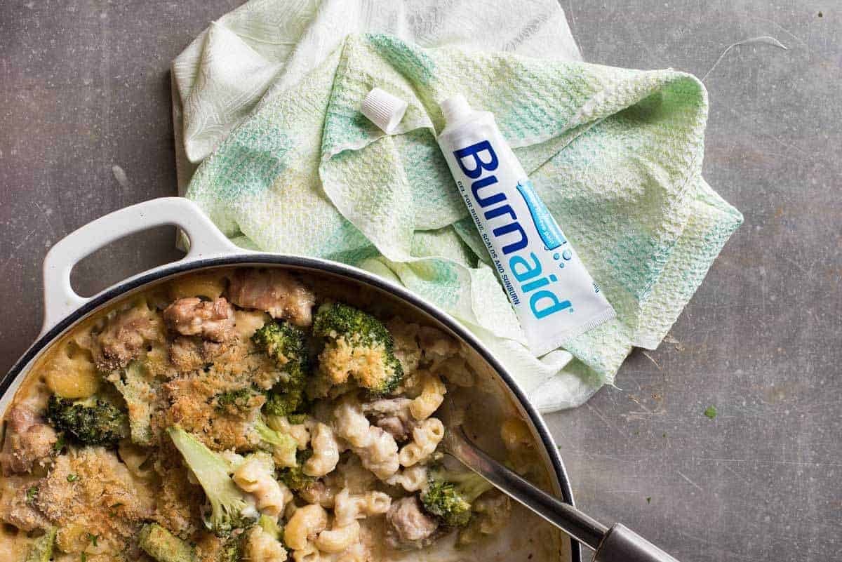 How To Treat Kitchen Burns - RecipeTin Eats